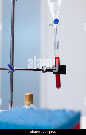 Blood sample ready for biological examination during microbiology ...