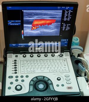 Legs ultrasound scan veins and arteries of woman. Vascular surgeon ...