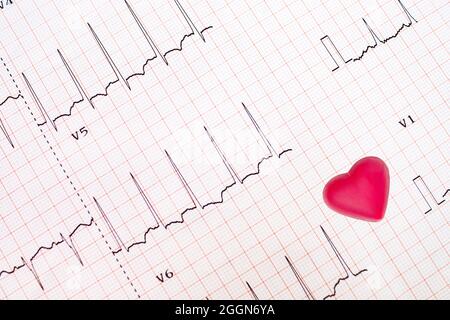 Heart disease. Abnormal electrocardiogram (ECG) of the heartbeat of a ...