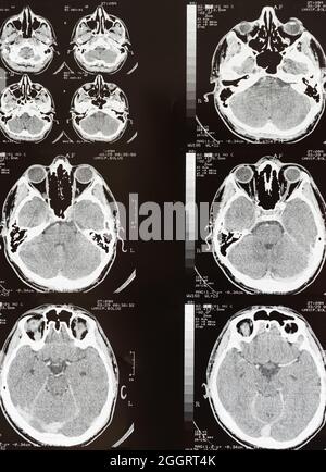 NMR (Nuclear Magnetic Resonance), medical imaging for diagnosis Stock ...