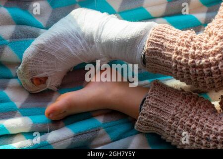 Boy with leg in plaster on crutches ; Malvani slum ; Malad ; Bombay ...
