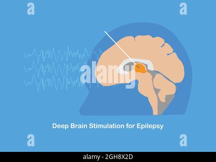 Brain circuit and brain waves technology background. Vector ...