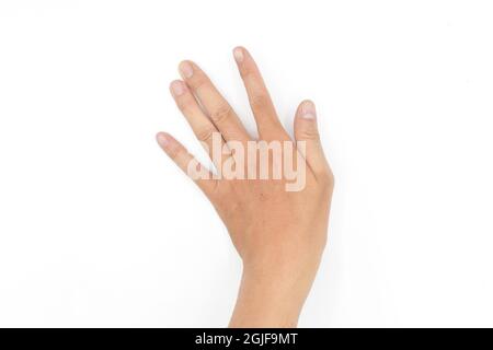 Fingers rigidity, Hand muscles spasm, or Weakness of digits. Closeup ...