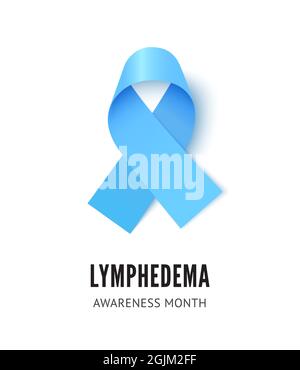 vector illustration of a Lymphedema of the disease Stock Vector Image ...