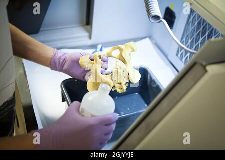 3D reconstruction from patient images, 3D printed pelvis Stock Photo ...