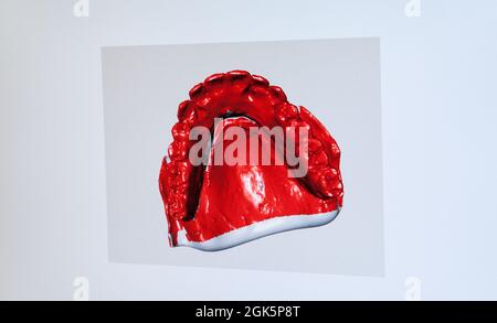 Dental prostheses and Computer Aided Design Manufacturing system from a ...