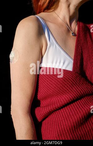 woman wearing a mobile medtronic insulin pump for her diabetes Stock ...