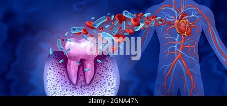 Tooth decay and blood bacteria and disease as an unhealthy molar with ...