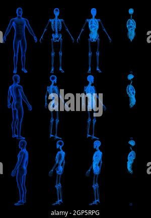 cg medicine 3d illustration, lungs affected by pill Stock Photo - Alamy