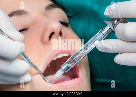 Dental surgeon injecting anesthesia in the mouth. Three people. Dental ...