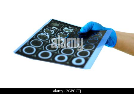 The doctor holds a CT scan of a patient with temporomandibular joint ...