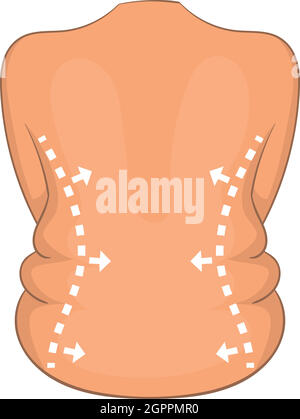 Body contouring isolated concept vector illustration. Non surgical ...