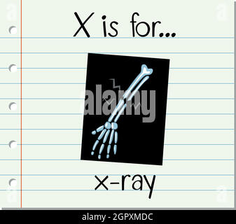 Alphabet flashcard with letter X for X-ray illustration Stock Vector ...