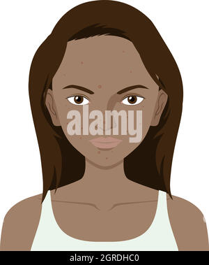 Woman with facial skin problem Stock Vector Image & Art - Alamy