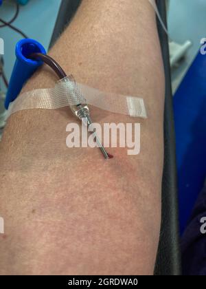 A blood donor gives blood in an NHS blood donation centre with needle ...