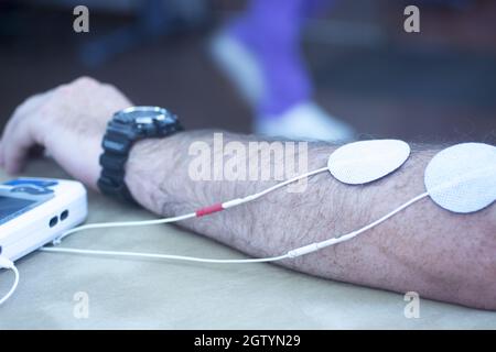 Electro physiotherapy electrical impulse stimulation rehabiliation ...
