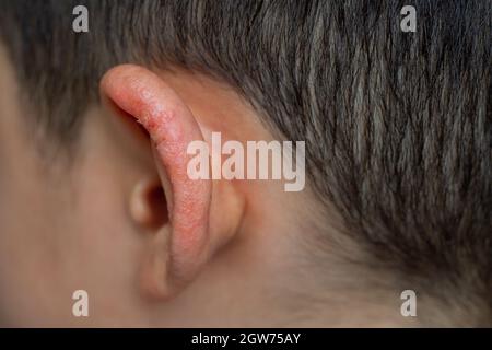 close -up shot of a human earlobe with cartilage piercings Stock Photo ...