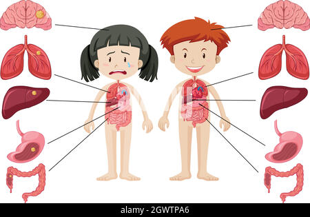 Anatomy of the human healthy and unhealthy stomach, medical poster with ...