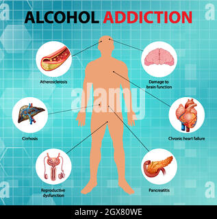 Alcohol addiction or alcoholism information infographic illustration ...