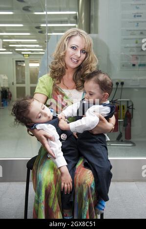 Conjoined twins separated Stock Photo - Alamy