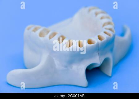 Upper human jaw without teeth model medical implant isolated on black ...
