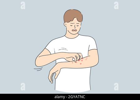 Unhappy sick man with red rash and spots on body. Unhealthy guy suffer ...