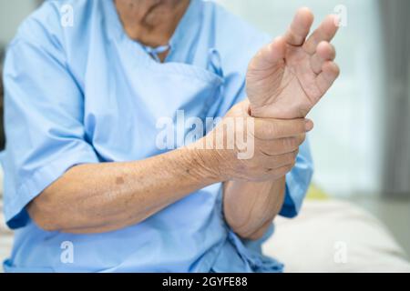 Gout. Close-up of the hand of a patient suffering from gout, showing ...