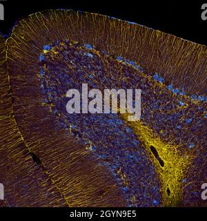 Sagittal section of mouse cerebellum labelled with immunofluorescence ...