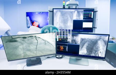 An operation room in a hospital is where Coronary Artery Bypass Grafts ...