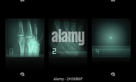 3d illustration - x-ray panels on black background Stock Photo - Alamy