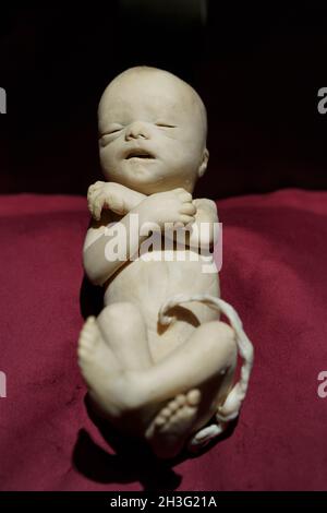 Specimen of Week 24 of pregnancy seen during the exhibition."Body ...