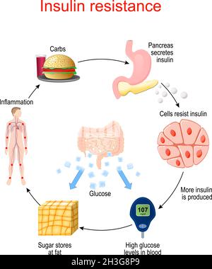 Pancreas respond to high glucose level by secreting insulin. Alpha cell ...