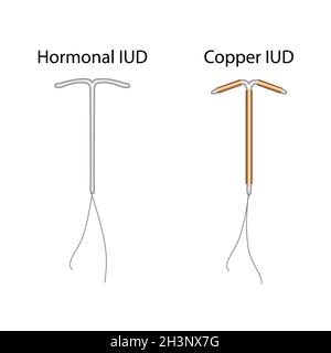 Intrauterine devices, illustration Stock Photo - Alamy