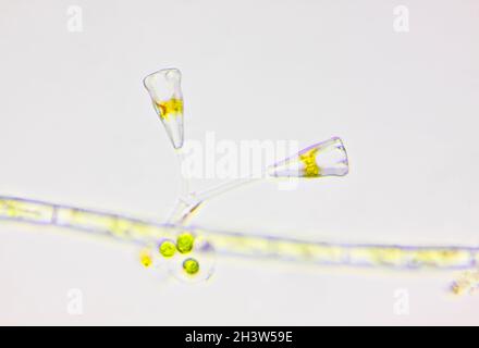 Microscopic view of a diatom. Brightfield illumination Stock Photo - Alamy