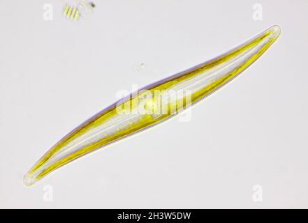 Microscopic view of a diatom. Brightfield illumination Stock Photo - Alamy