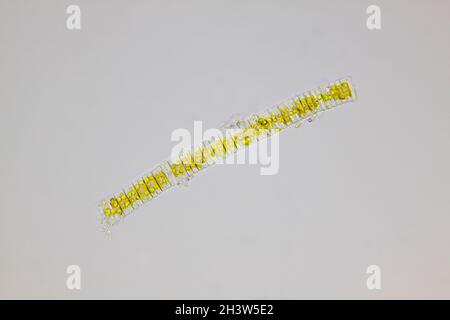 Microscopic view of a diatom. Brightfield illumination Stock Photo - Alamy