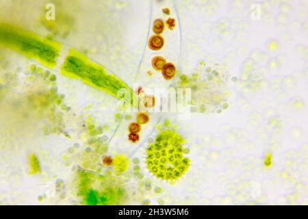 Microscopic view of colonial green algae Coelastrum between single-cell ...