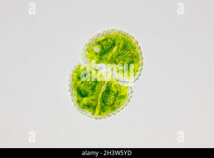 Microscopic view of green algae (Cosmarium) inside empty Ostracod shell ...