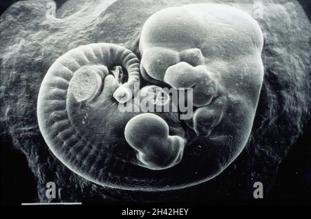 SEM of mouse foetus Stock Photo - Alamy