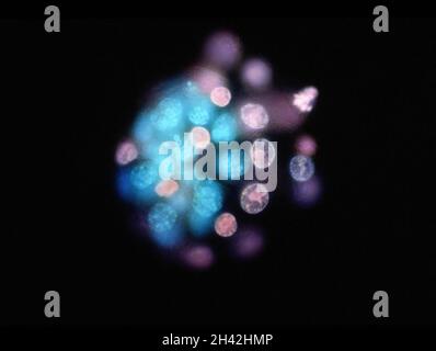 Mouse Blastocyst showing inner cell mass Stock Photo - Alamy