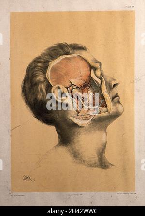 Dissection of the side of the face, with the muscles and blood vessels ...
