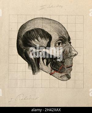 Écorché head of a man, shown at layer beneath superficial muscles, seen ...