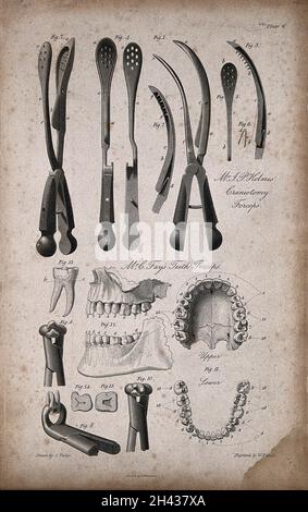 . A system of obstetrics . Forceps Delivery of the After-coming Head in ...