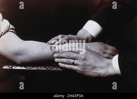 Two hands held on either side of a dark mark on a forearm, to ...