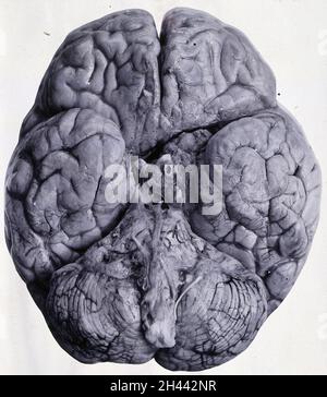 Friern Hospital, London: a brain, seen from beneath, 1890/1910. Friern ...