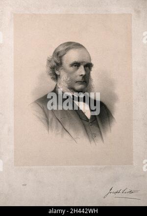 Joseph Lister, a pioneering British surgeon, developed antiseptic ...