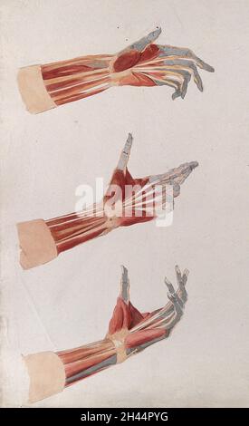 Three dissections of the left hand and wrist, showing the muscles and ...