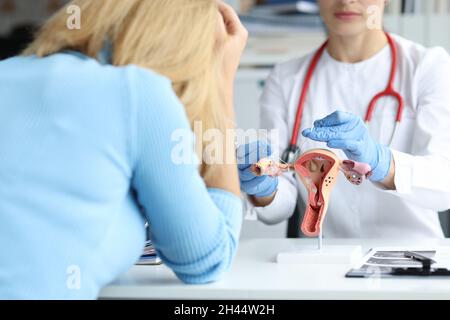 Anatomical model of female genital organs Stock Photo - Alamy