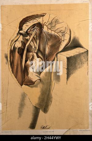 Dissection of the thigh of a man, showing the muscles, arteries, veins ...