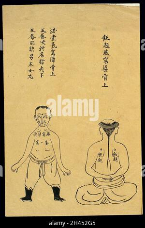 C19 Chinese ink drawing: Location of various boils Stock Photo - Alamy
